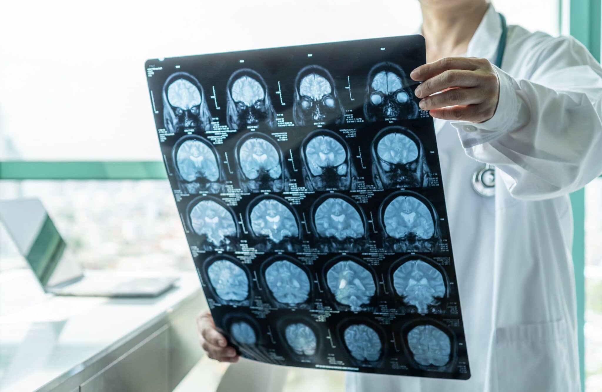 Understanding Addiction as a Disease - Drug & Alcohol Rehab - Bradford